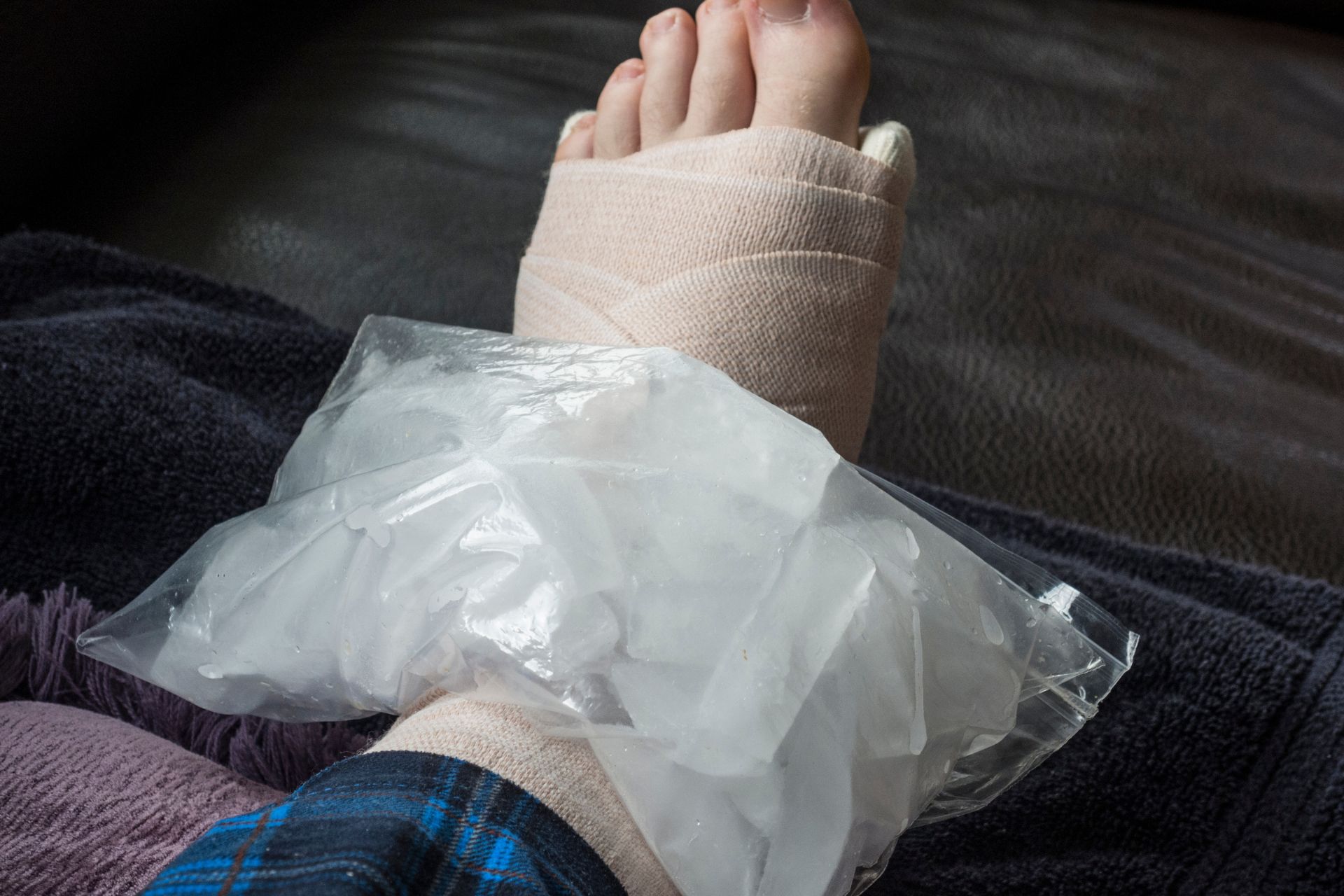 When to Use Ice vs. Heat for Common Foot Conditions